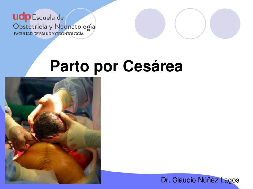 Cesarea | luna mil | uDocz