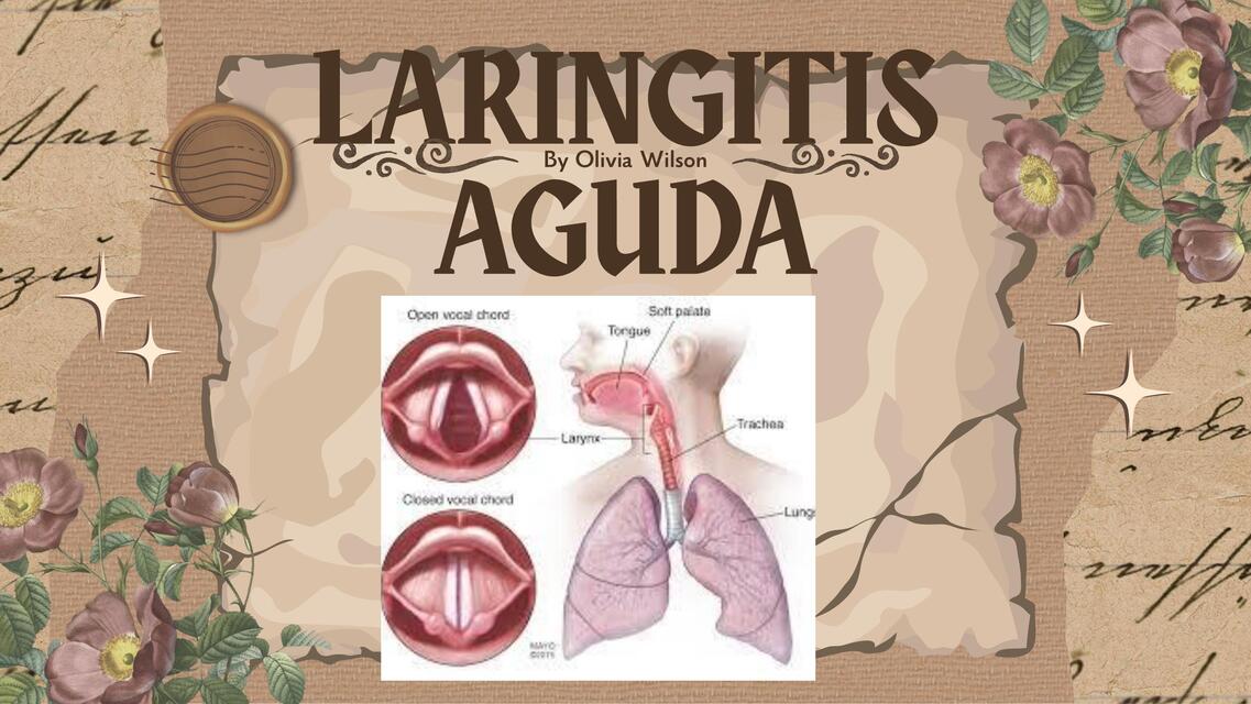 laringitis aguda | panish | uDocz