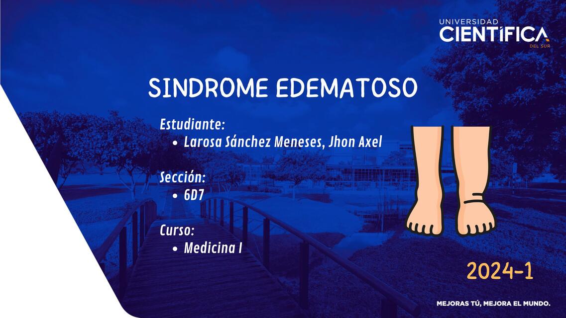 SÍNDROME EDEMATOSO | 3282828282lsls | uDocz