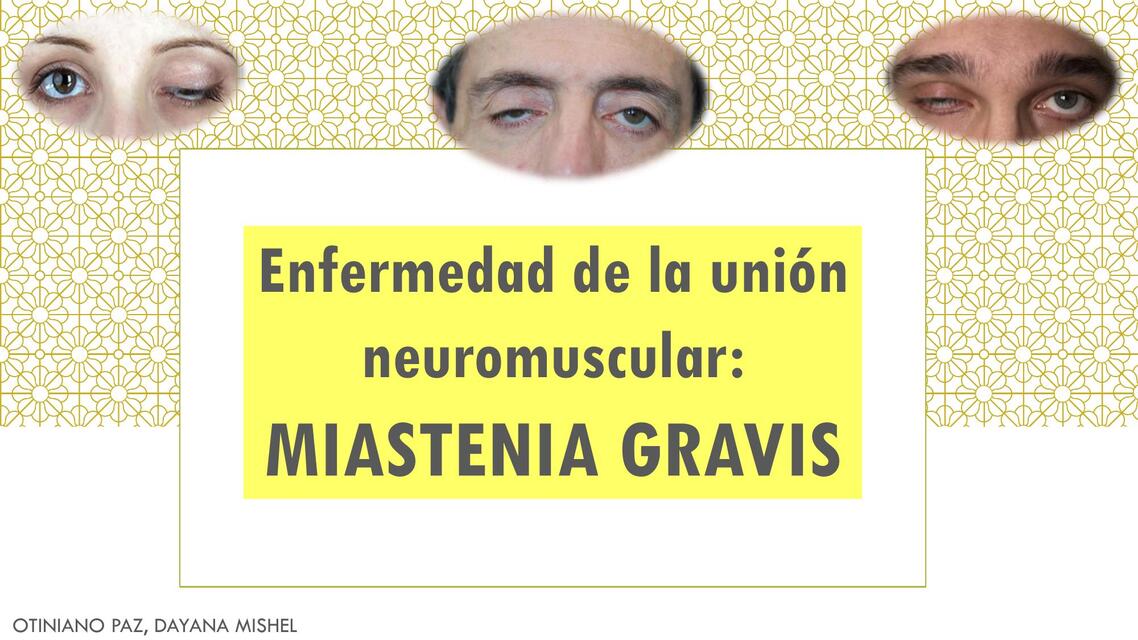 MIASTENIA GRAVIS | Wilfried Quincho Jeronimo | uDocz