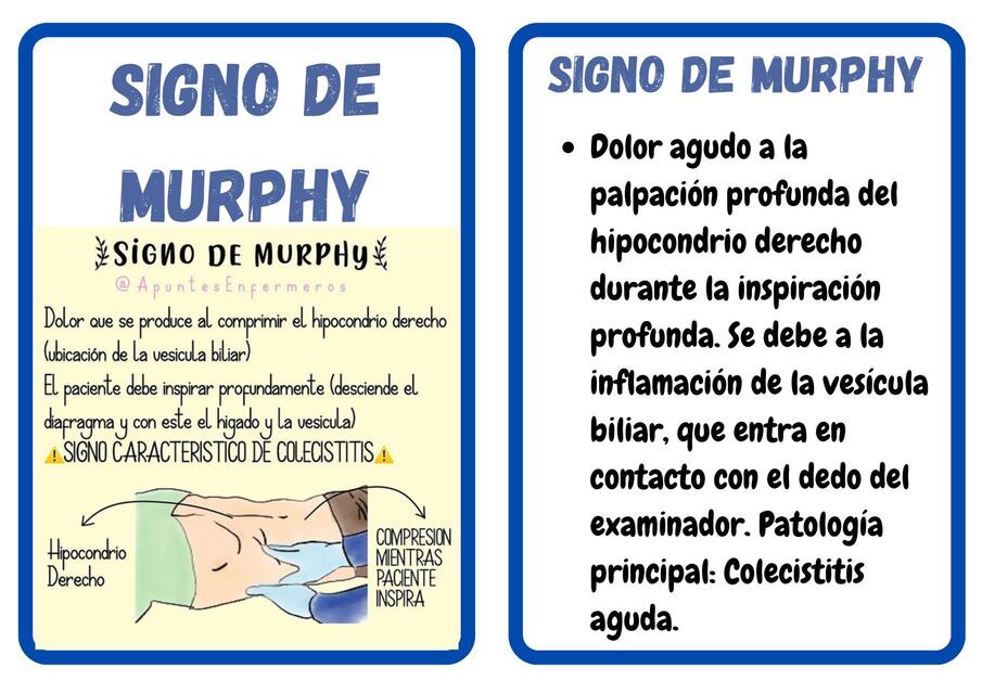 Signo De Murphy Colecistitis Medicovers Criterios Para Diagnóstico