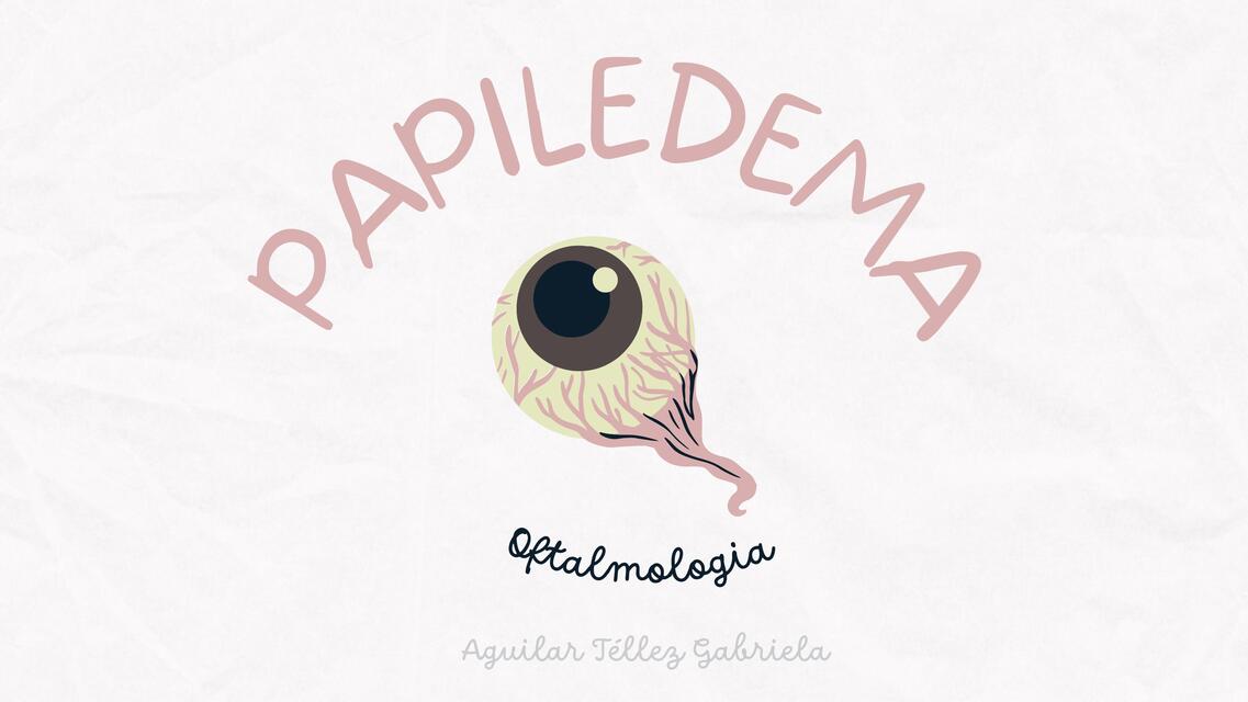 Papiledema y NOI | Gabriela Aguilar Tellez | uDocz