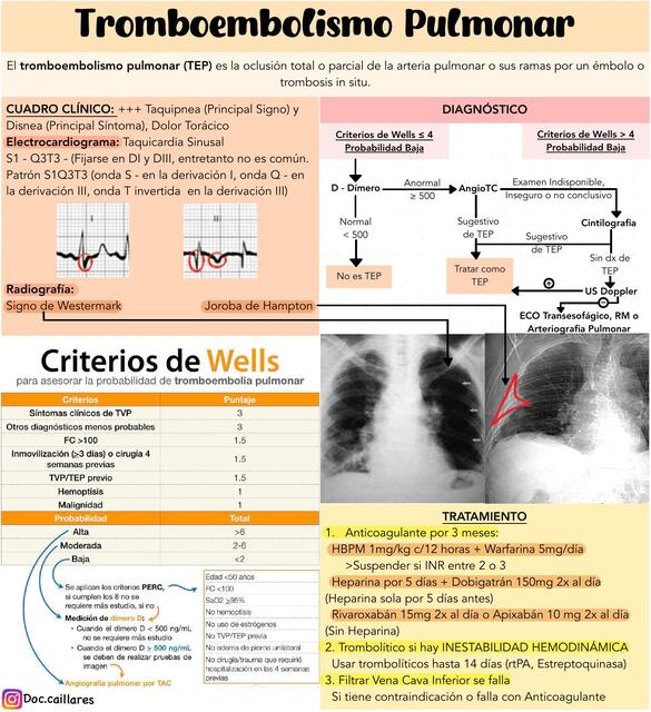 TROMBOEMBOLISMO PULMONAR | Dr. Boris Moises Caillares Montaño | uDocz