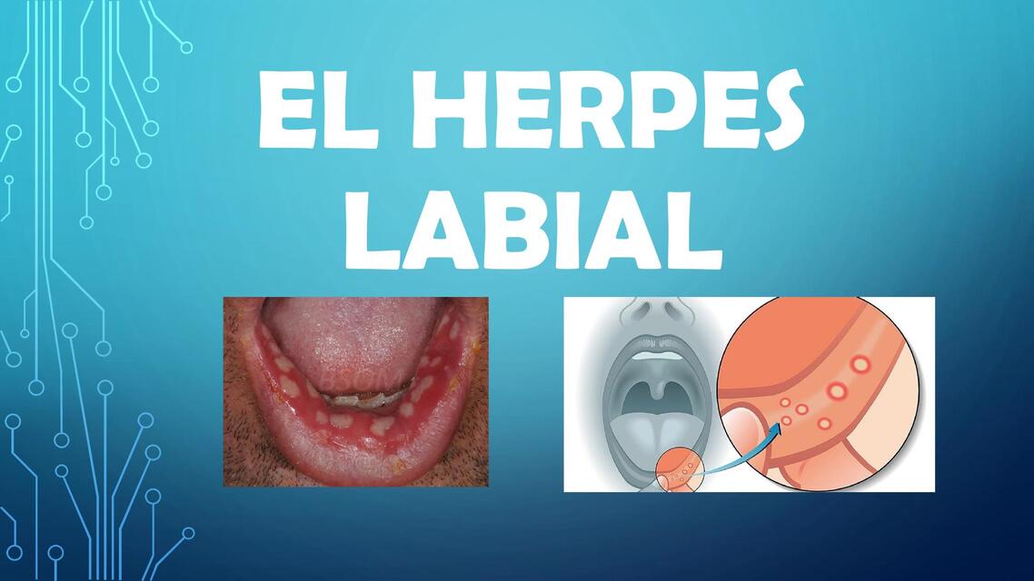 El herpes labial | Angie Perez cusi | uDocz