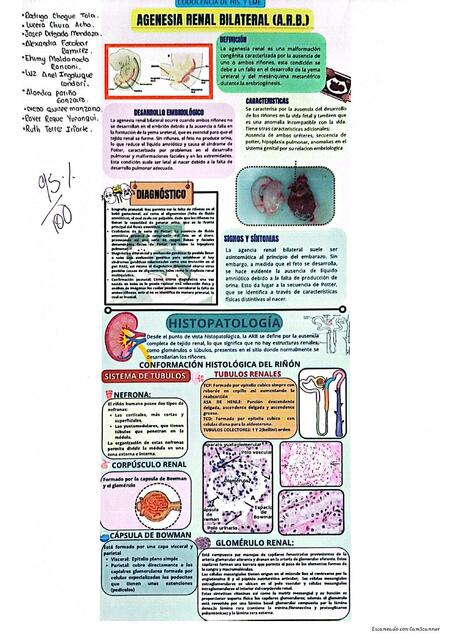 AGENESIA RENAL BILATERAL 2 | BRAYAM RODRIGO | uDocz