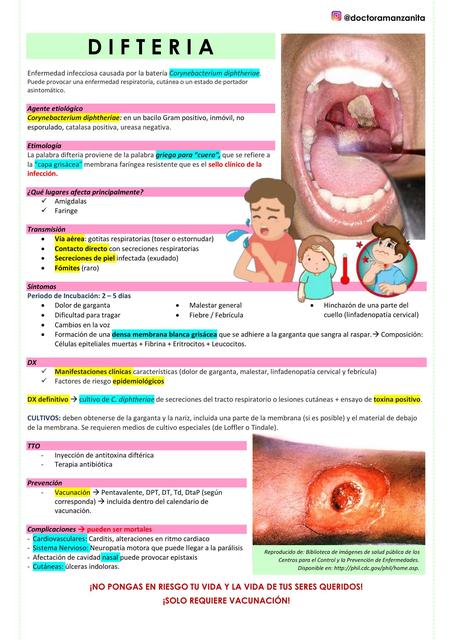 Resúmenes de Difteria | Descarga apuntes de Difteria