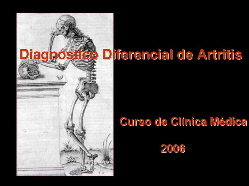 Artralgia y artritis | Ahmed Casana | uDocz