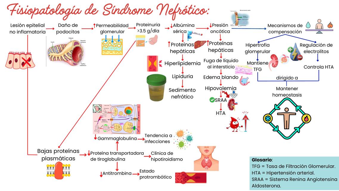 Fisiopatología de Síndrome Nefrótico: | WILSON ELIAS LOPEZ VARGAS | uDocz