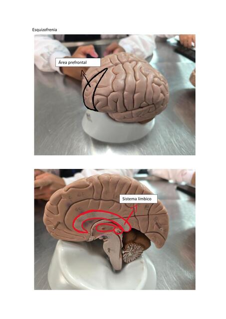 Trabajo neuro | Juan | uDocz