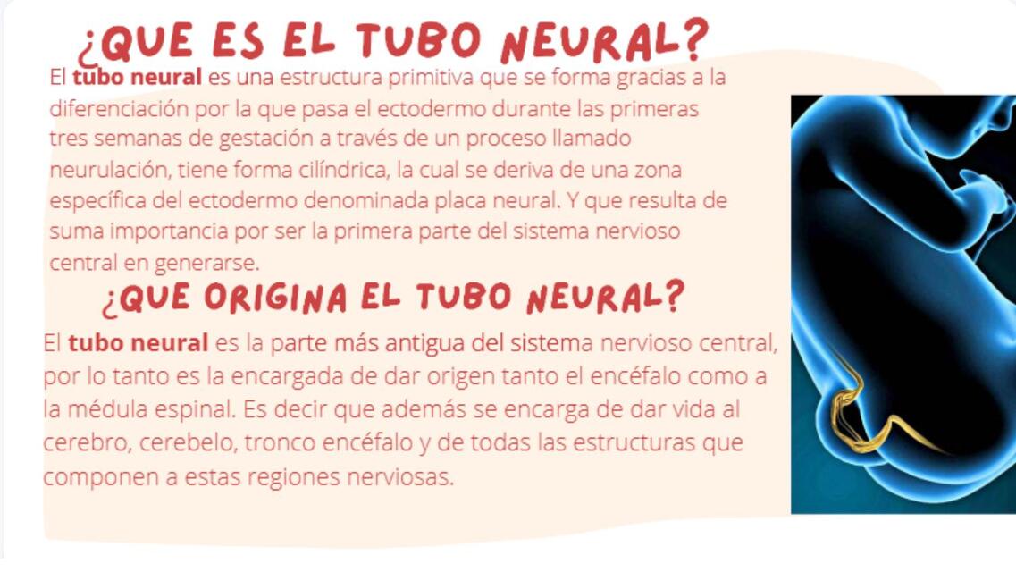 Defecto del tubo neural | Marlene Olinda Arrascue campos | uDocz