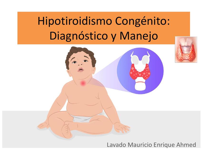 Hipotiroidismo Congenito Enrique Lavado Mauricio | Marlene Olinda Arrascue campos | uDocz