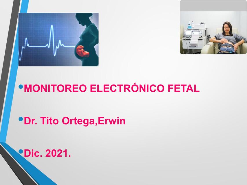 MONITOREO ELECTRÓNICO FETAL ppt | Mishelle Chavez | uDocz