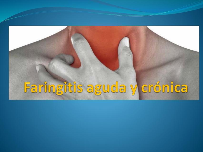 Orofaringe: Amigdalitis aguda y crónica | Morales Lizeth | uDocz