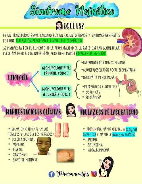 Síndrome Nefrótico - RESUMEN | Pharmaceu_Tips | uDocz