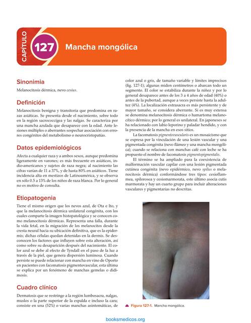 15 3 Mancha mongólica | Mónica | uDocz