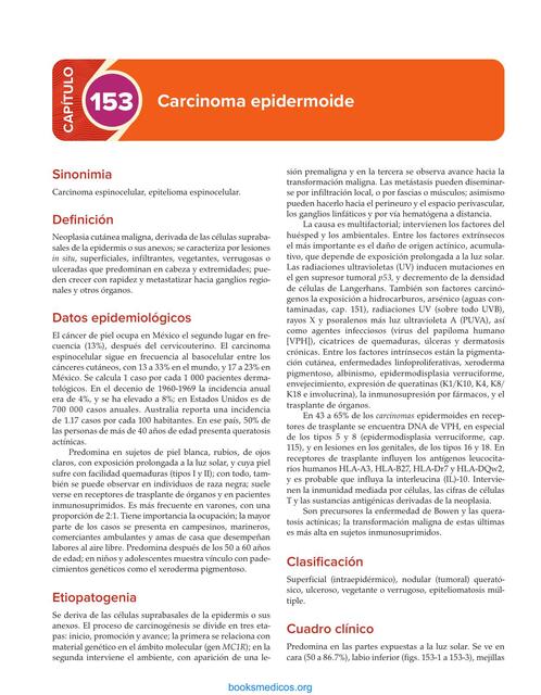 14 2 Carcinoma de células escamosas espinocelular | Mónica | uDocz
