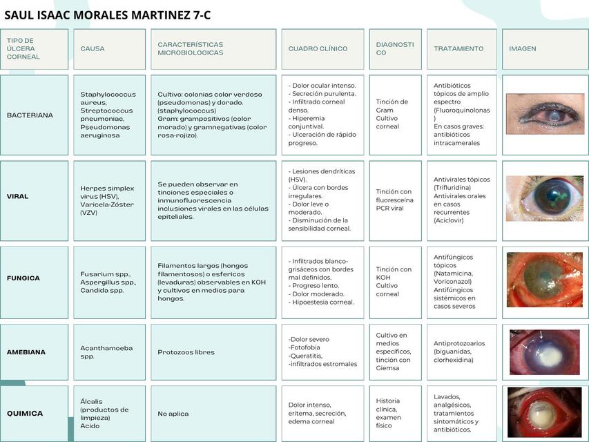 Cuadro comparativo Úlceras corneales | Morales Martínez | uDocz
