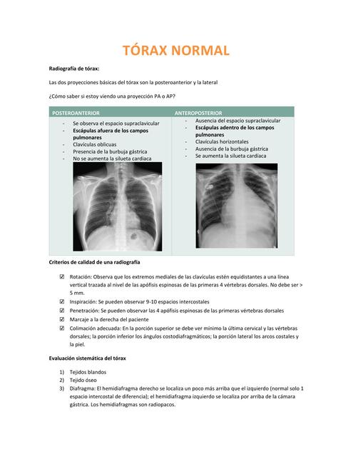 Tórax normal y patológico | Paola Monroy | uDocz