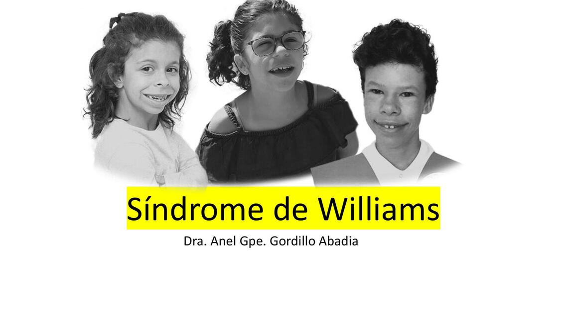 Síndrome de Williams | Anel | uDocz