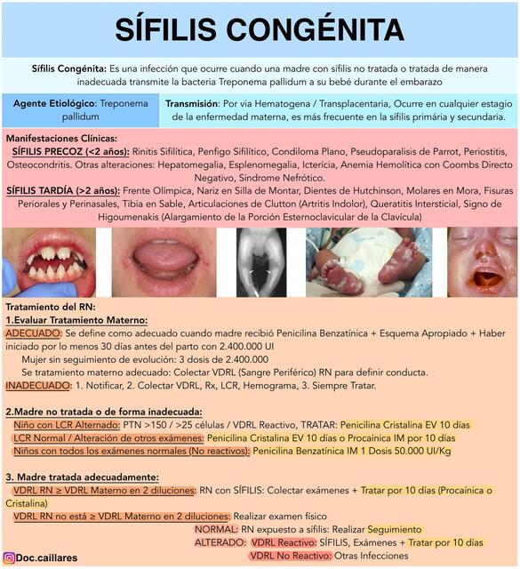 SÍFILIS CONGENITA | Dr. Boris Moises Caillares Montaño | uDocz