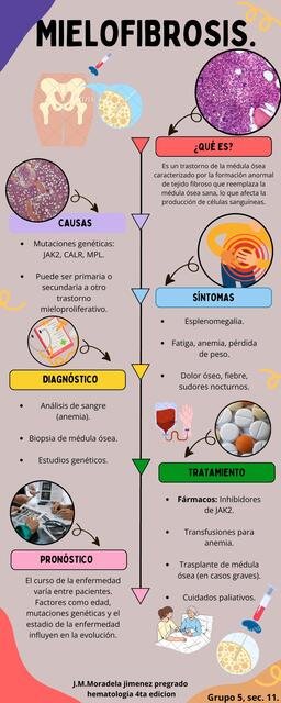 Infografia Mielofibrosis 1 | Ashley Santana | uDocz