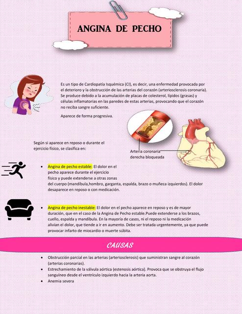 ANGINA | uDocz