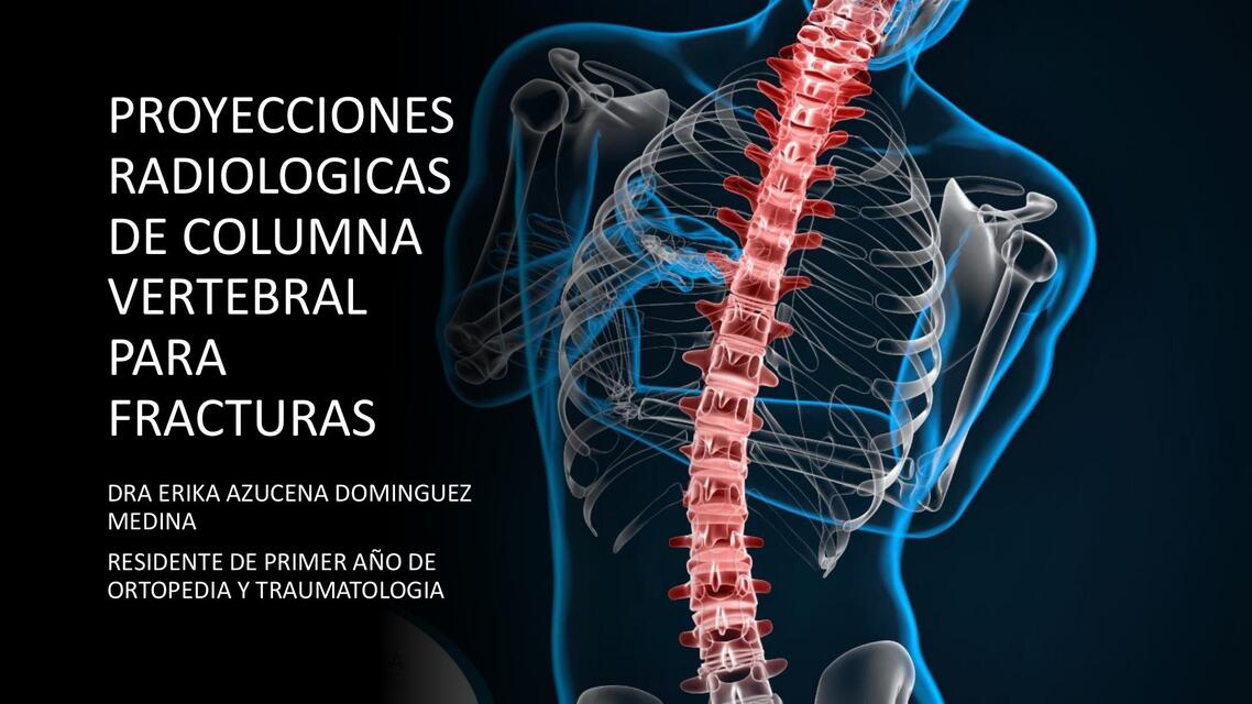 PROYECCIONES RADIOGRAFICAS PARA COLUMNA VERTEBRAL | Azucena Domínguez ...