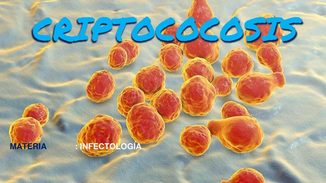CRIPTOCOCOSIS | Criptococosis | Criptococosis | uDocz