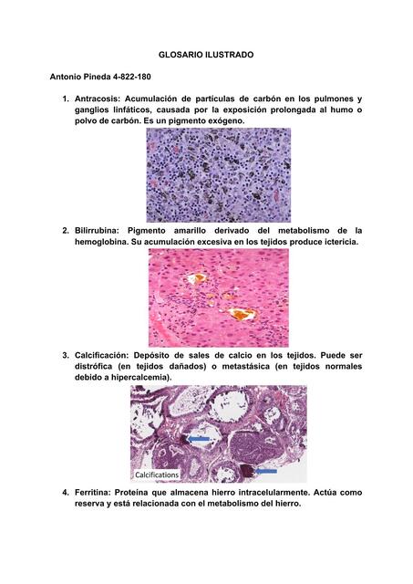 GLOSARIO ILUSTRADO 1 | Antonio Pineda | uDocz