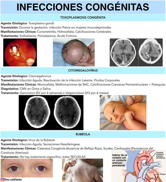INFECCIONES CONGÉNITAS | Dr. Boris Moises Caillares Montaño | uDocz