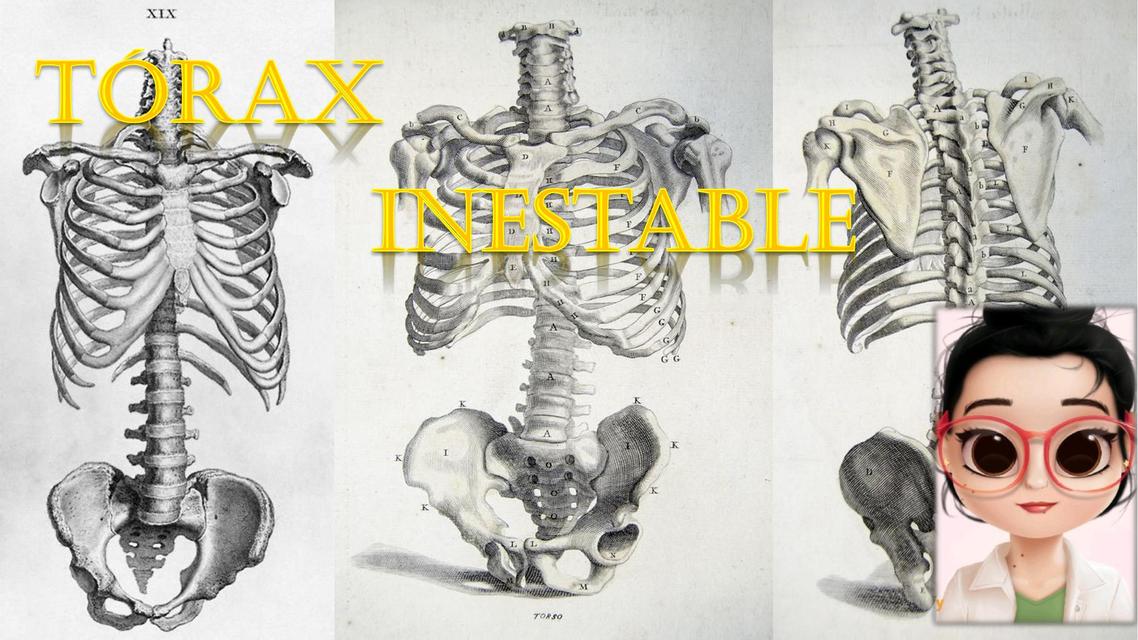 Tórax Inestable | uDocz creators | uDocz