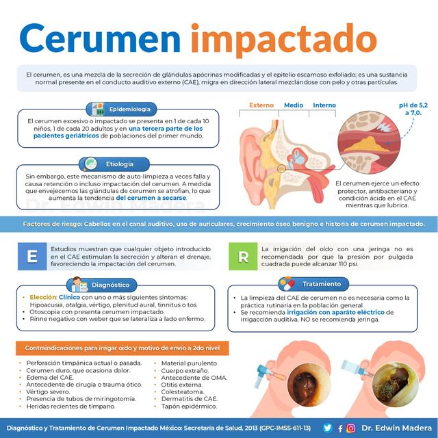 Cerumen impactado | Paulina Negrete | uDocz