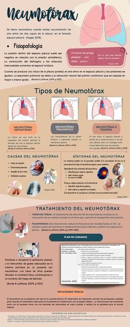 Infografia Neumotórax | Julissa Mendoza | uDocz