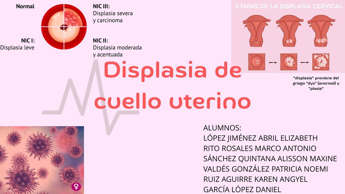 Displasia de cuello uterino | Marco Antonio | uDocz