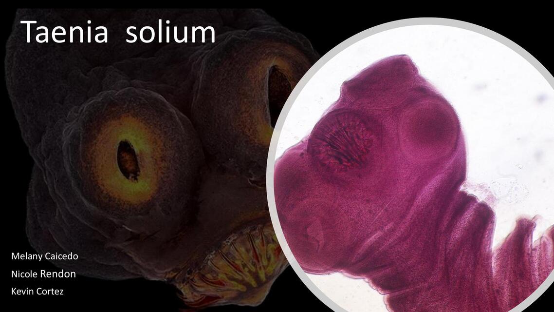 TAENIA SOLIUM | Nicole Rendón | uDocz