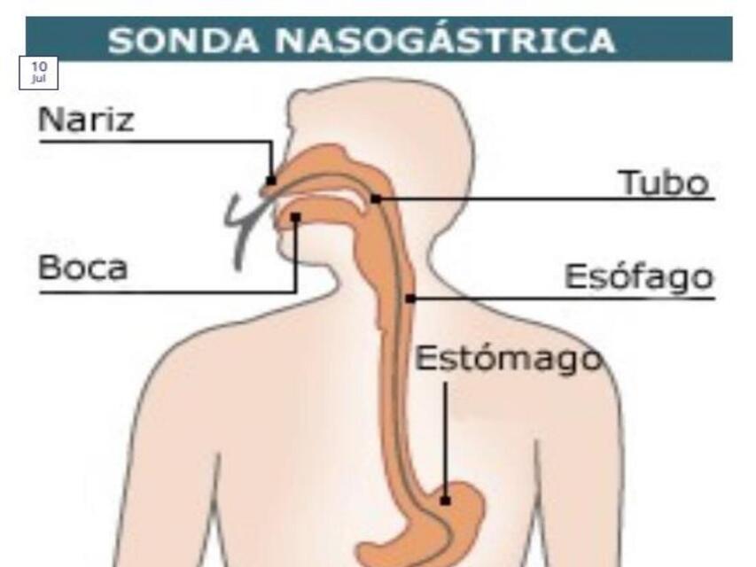 sondanasogastrica luz luz 1 | Anny Moreno | uDocz