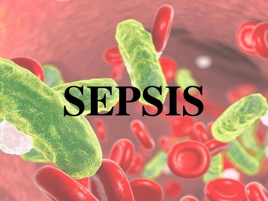 Sepsis | Sorlix | uDocz