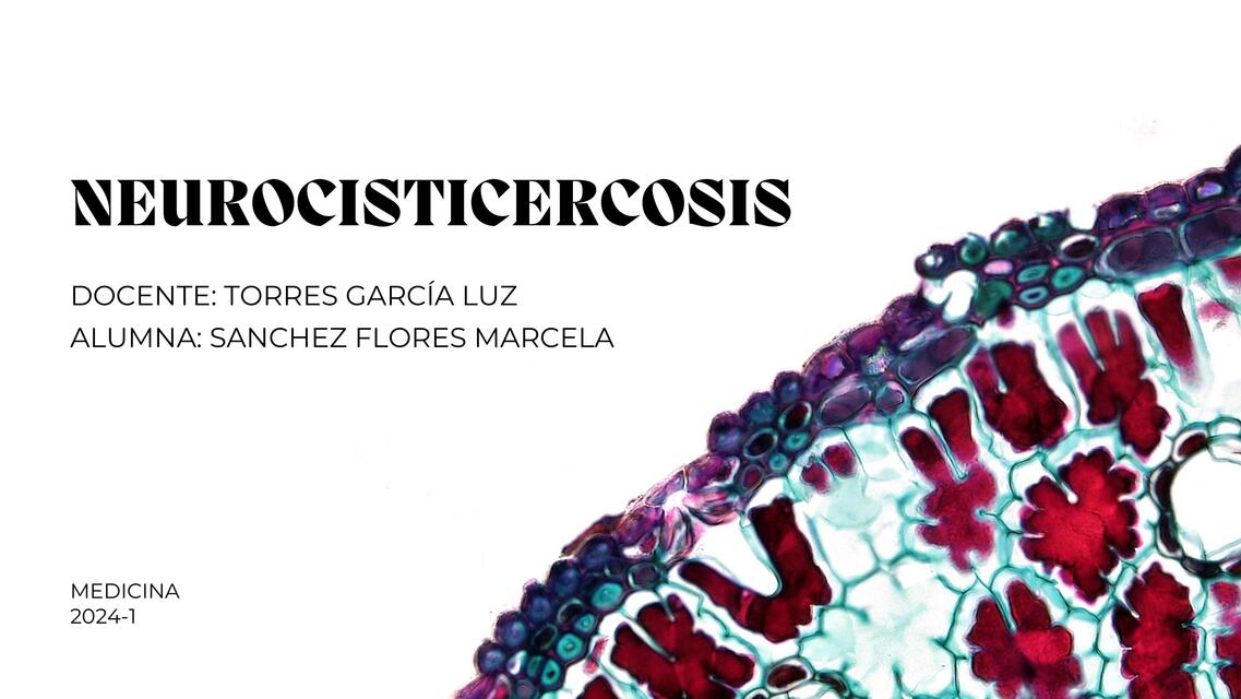 NEUROCISTICERCOSIS | MARCELA SANCHEZ FLORES | uDocz