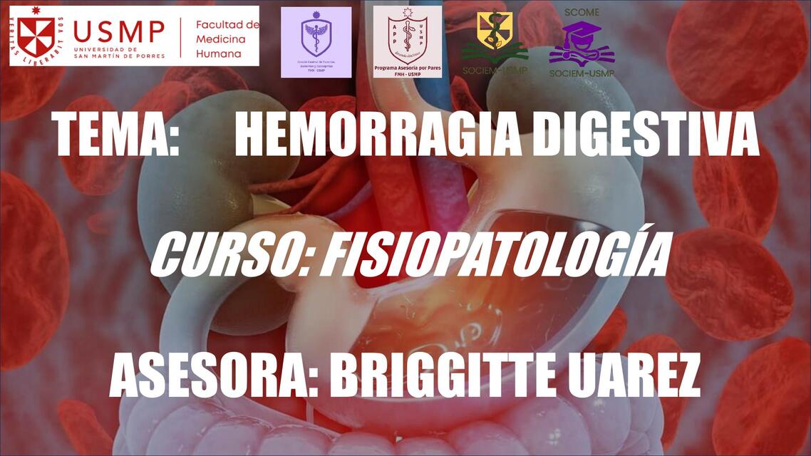 FISIOPATOLOGIA DE LA HEMORRAGIA DIGESTIVA | Briggitte Yamilé Suarez Esteban | uDocz