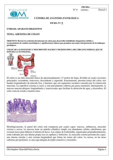 F9 ADENOMA DE COLON | christopher neira | uDocz