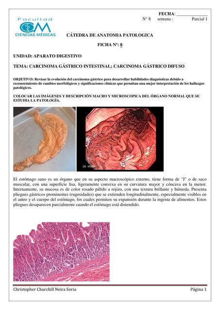 F8 CARCINOMA GASTRICO INTESTINAL Y DIFUSO copia | christopher neira | uDocz