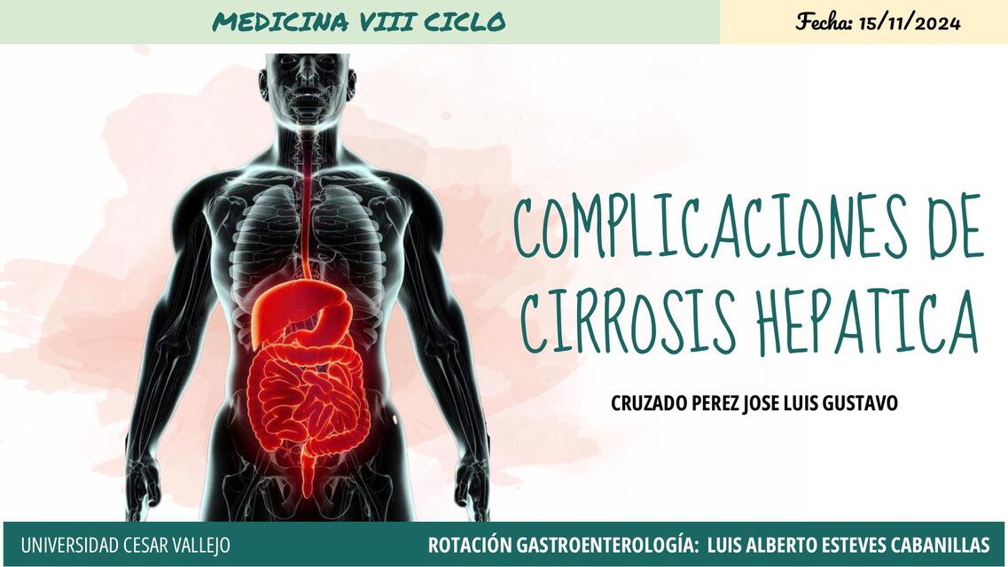 COMPLICACIONES CIRROSIS HEPATICA 2 | Luis | uDocz