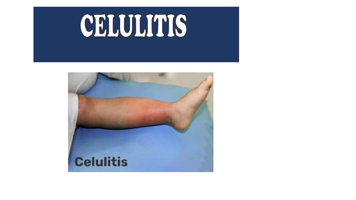 celulitis | Yelser PV | uDocz