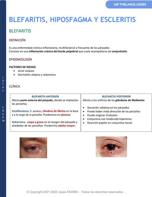 2 Blefaritis Hiposfagma Escleritis | MEDICSTORE | uDocz
