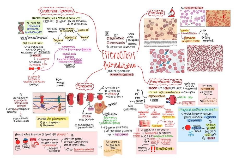Esferocitosis hereditaria | Ximenadbc🩺 | uDocz