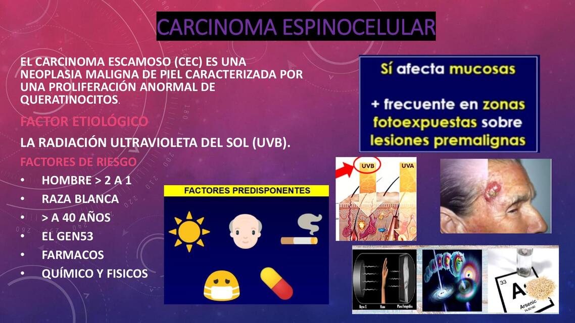 carcinoma espinocelular | Jose Francisco Abastoflor Parra | uDocz