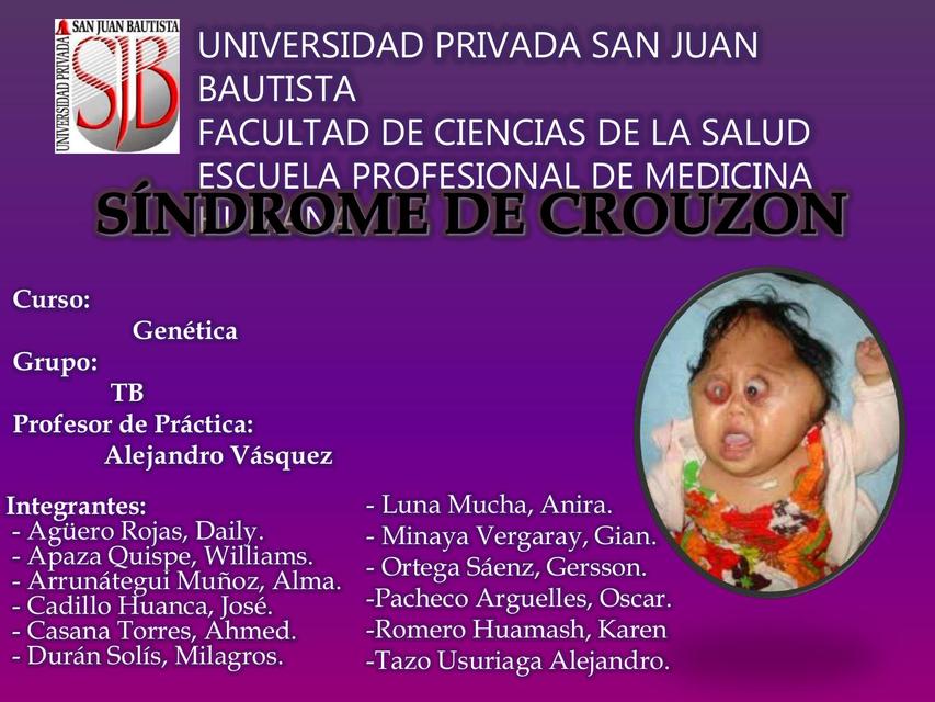Sindrome Crouzon | Ahmed Casana | uDocz