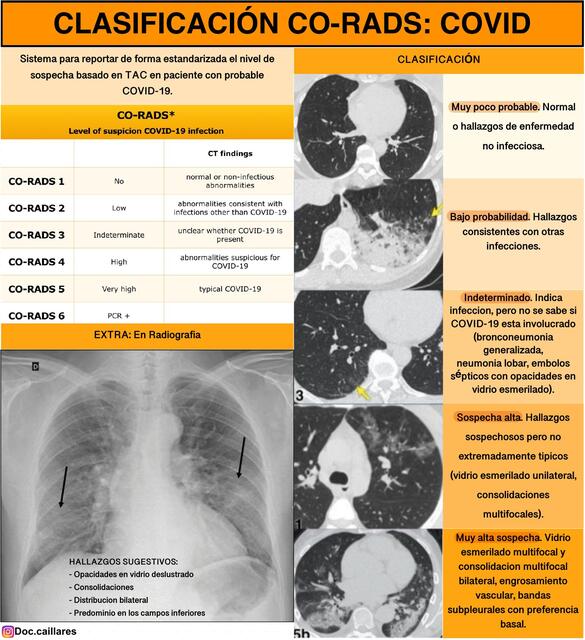 CLASIFICACIÓN CO RADS: COVID-19 | Dr. Boris Moises Caillares Montaño ...