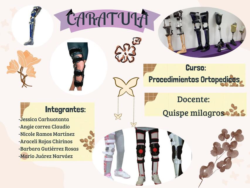 Aparatos Protésicos y Ortéticos de Miembro Inferio | Jessica ...