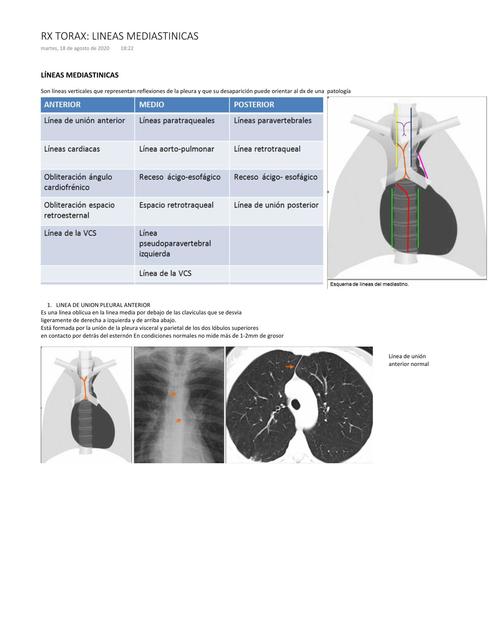 LINEAS MEDIASTINICAS | Christian Pesantez | uDocz